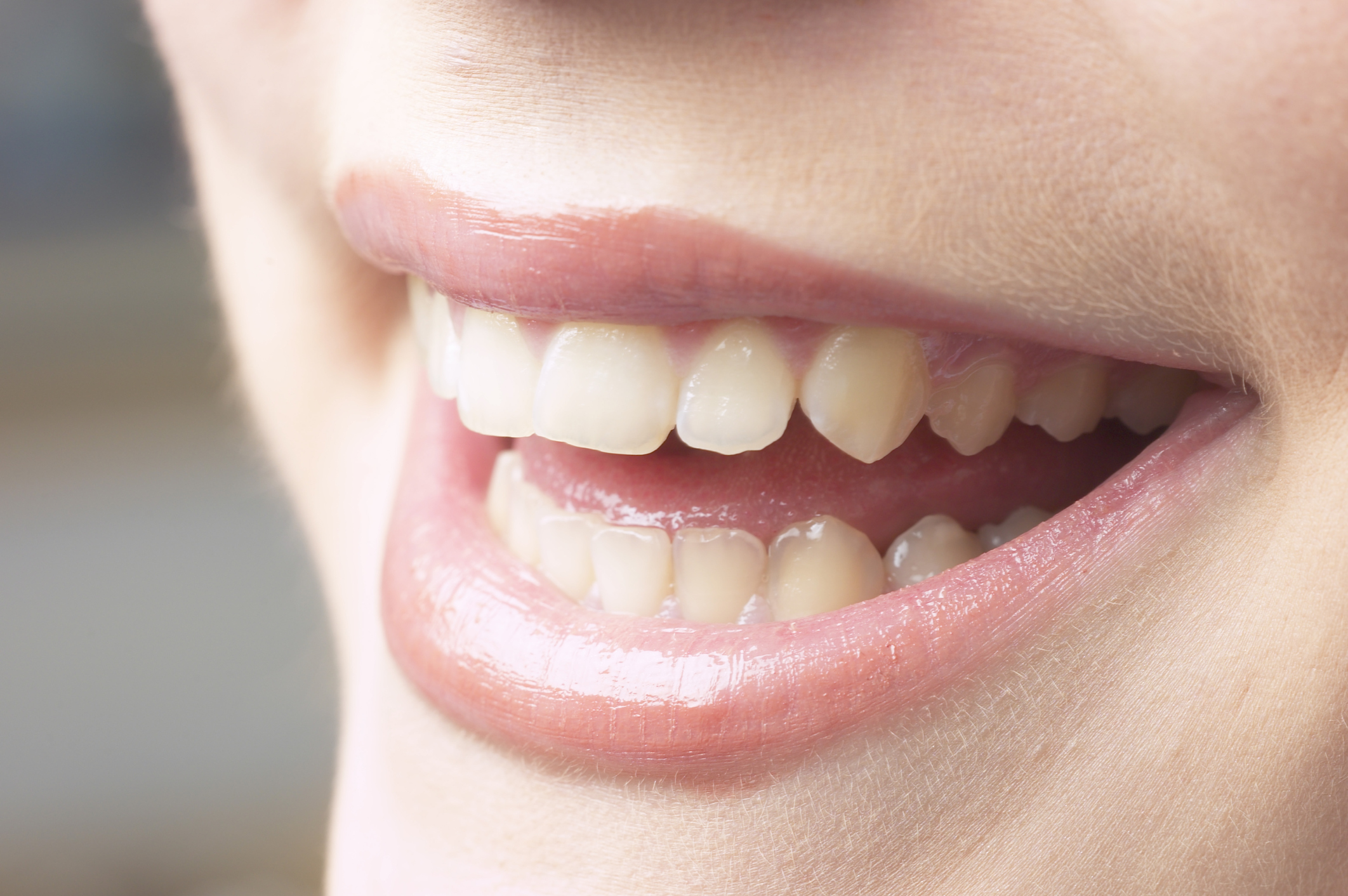 Thyroid Cancer And Tooth Decay