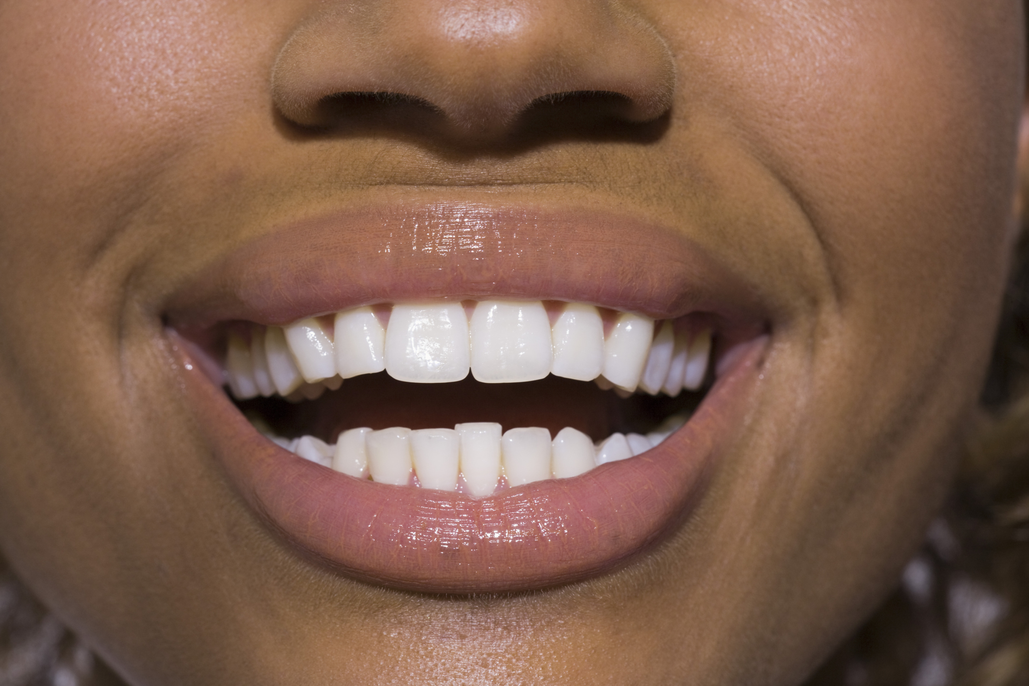 How To Make Your Own Tooth Caps Healthfully